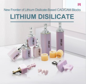 Classification Of All- Ceramic Dental Restoration Materials - Glorious ...